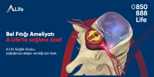 Bel Fıtığı Ameliyatı | A Life Sağlık Grubu